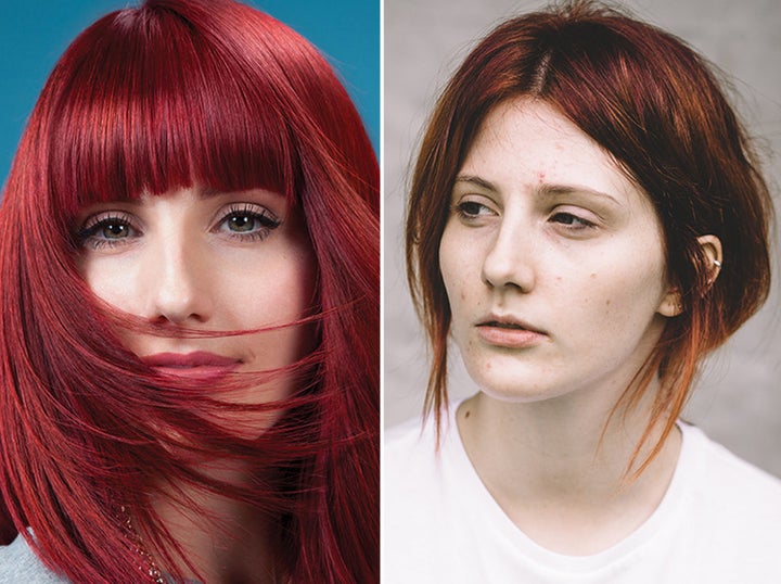 Fashion Blogger Reveals The 'True Face Of Depression' In Intimate ...