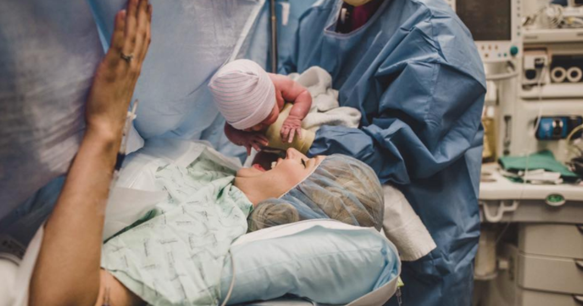 26 Stunning Photos That Capture The Sheer Strength Of C-Section Moms ...