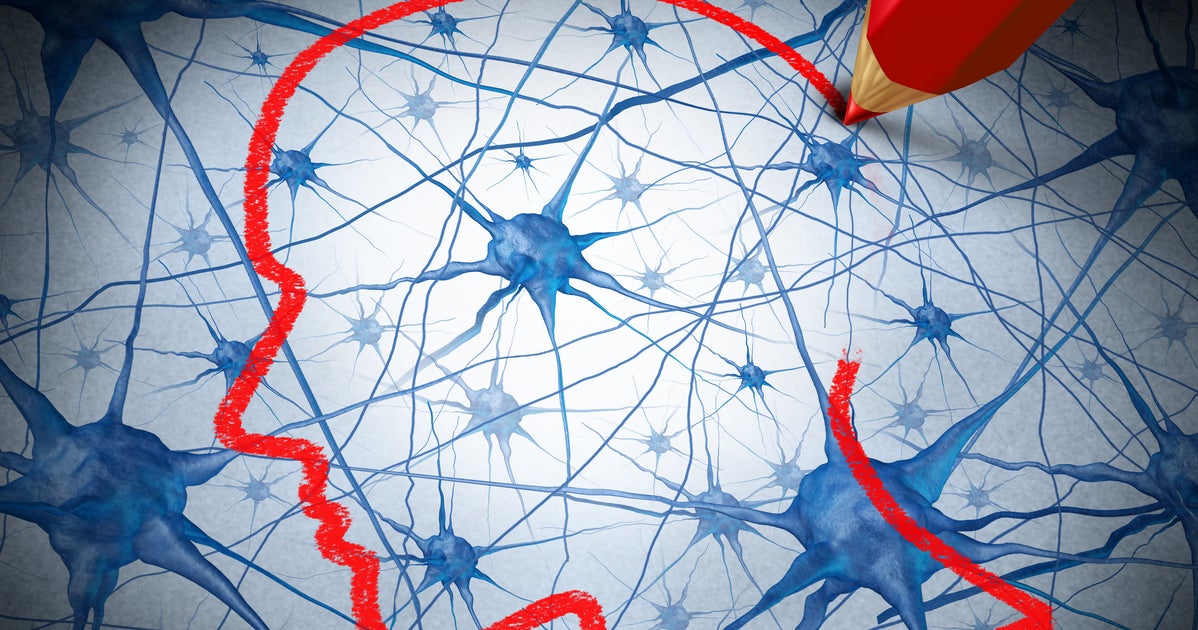 Largest Genetic Study To Date Reveals Broad Spectrum Of Autism ...