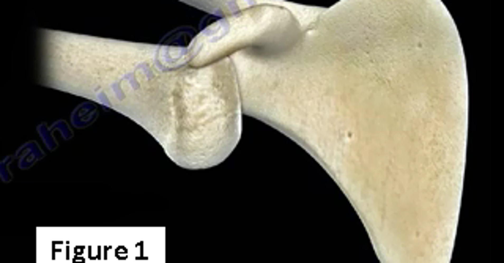 An Unusual Type of Shoulder Dislocation | HuffPost