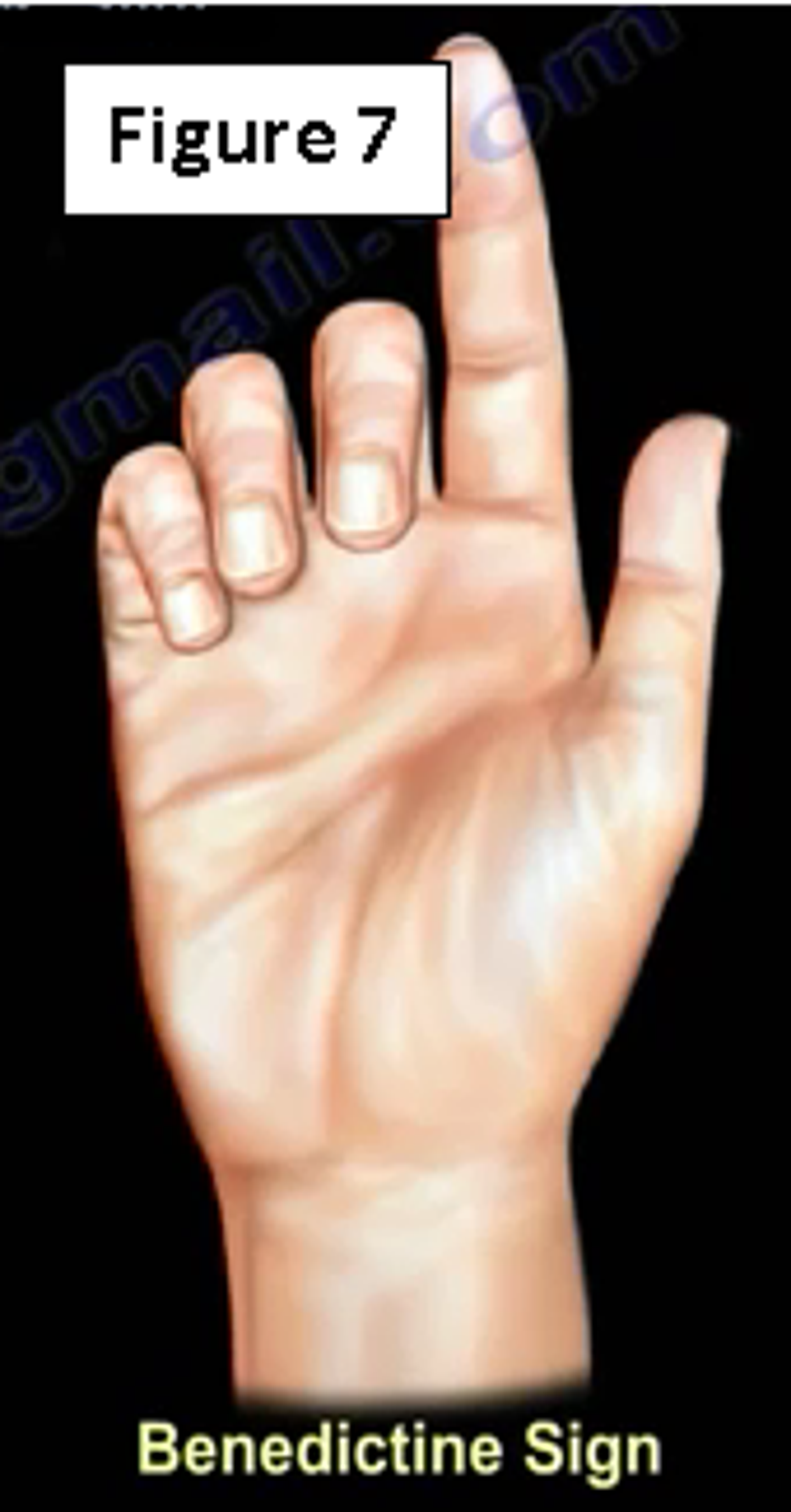 I Can't Do The OK Sign, What Does it Mean? | HuffPost Contributor