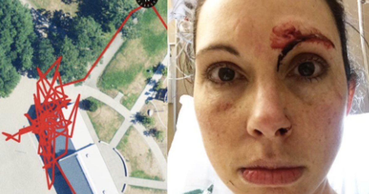 Kelly Herron Slams Group Using Her Attack In Anti-Transgender Bathroom ...