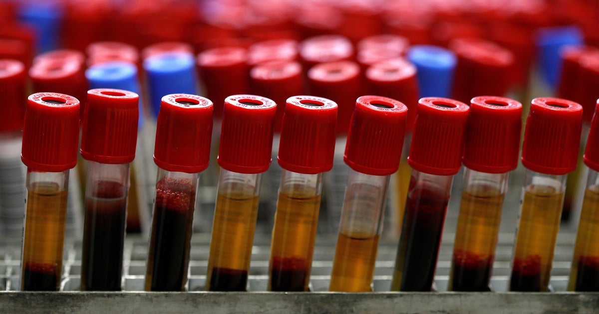 The World's First Cancer-Detecting Blood Test Could Be Ready Within A ...
