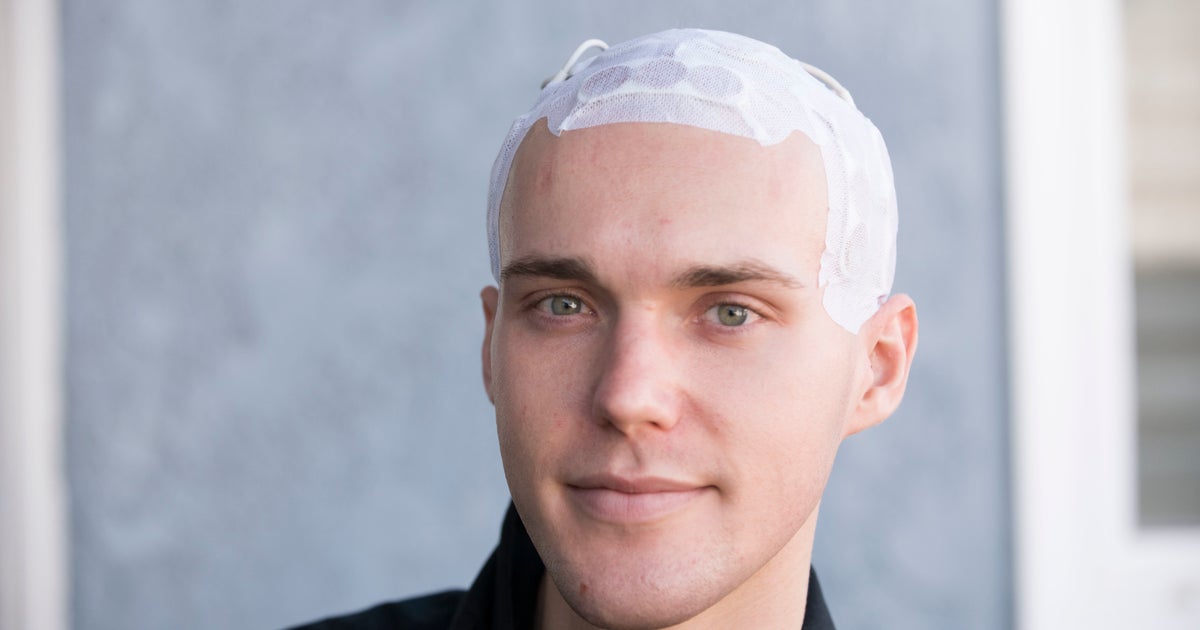 Sci-Fi Anti-Cancer Cap Is Producing Impressive Results | HuffPost UK Tech