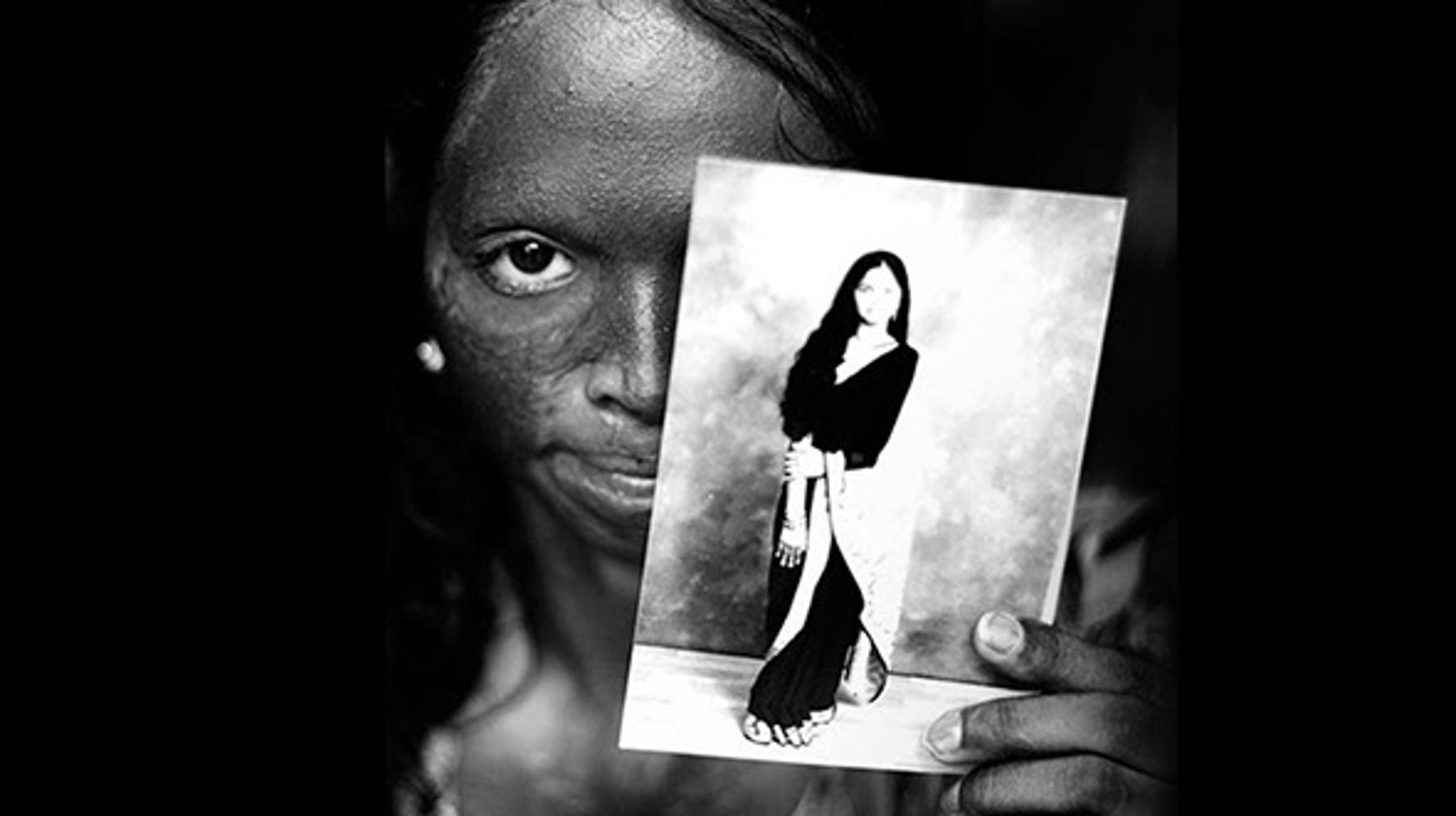 Stop Acid Attacks! | HuffPost Contributor Stop Acid Attacks! | HuffPost Contributor