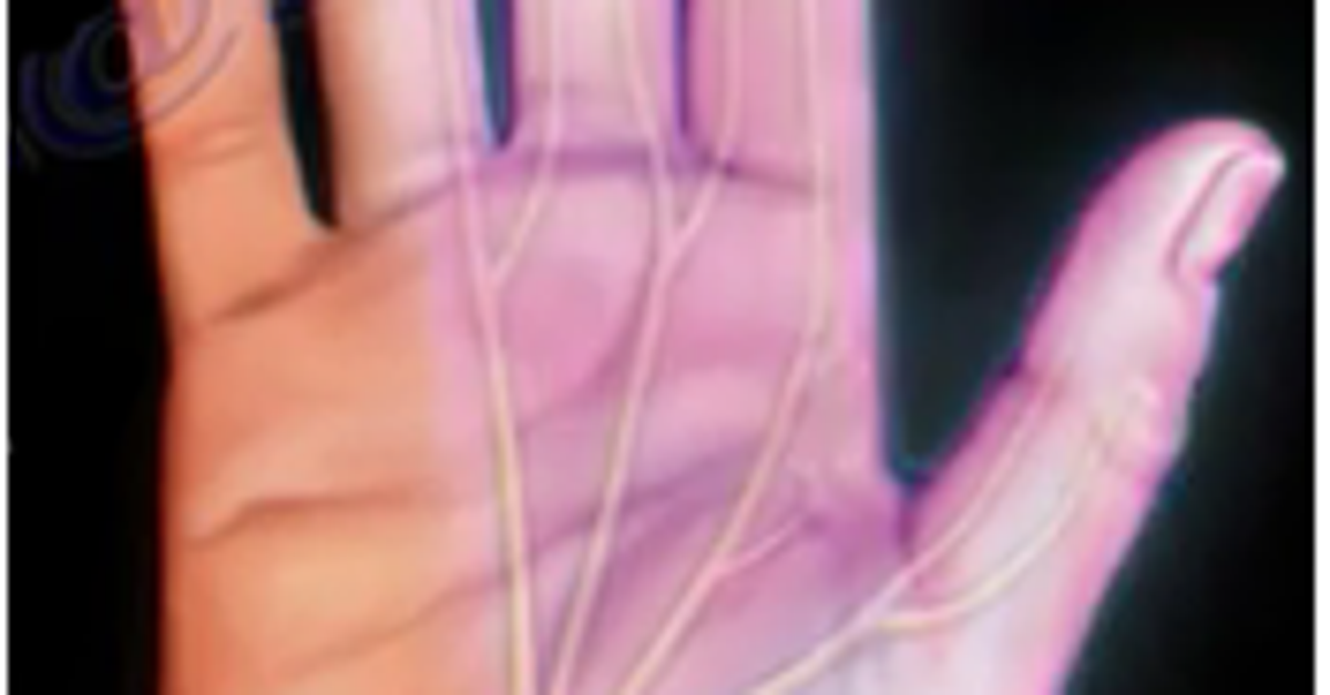 Common Hand and Finger Problems | HuffPost Contributor