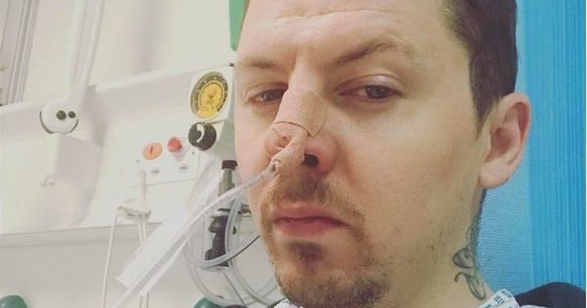 Professor Green Reveals Horror Hospital Battle After Rare Allergic ...