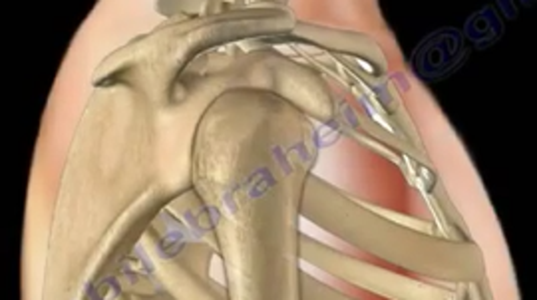 Shoulder Dislocations and Associated Lesions | HuffPost Contributor