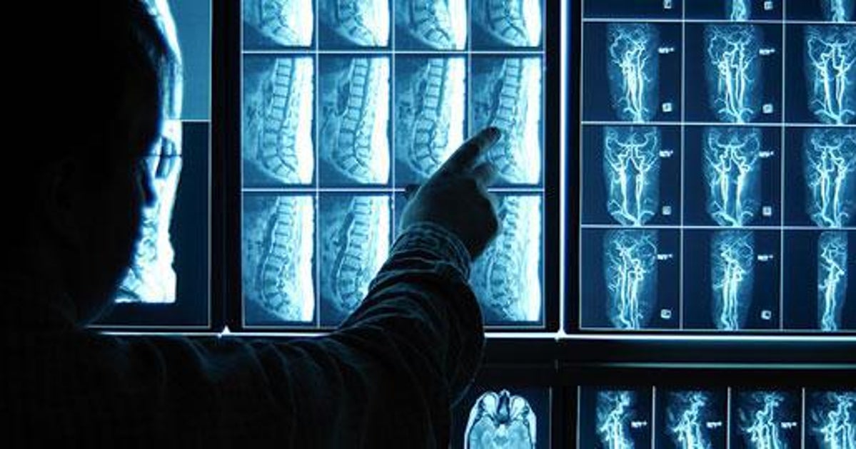 New Open Source Medical Image Repository Launches | HuffPost Contributor