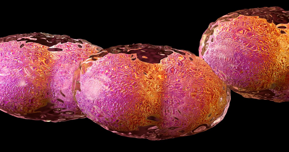 A Scientist Resurrected The Deadly Pox Virus Using $100,000 And Mail ...