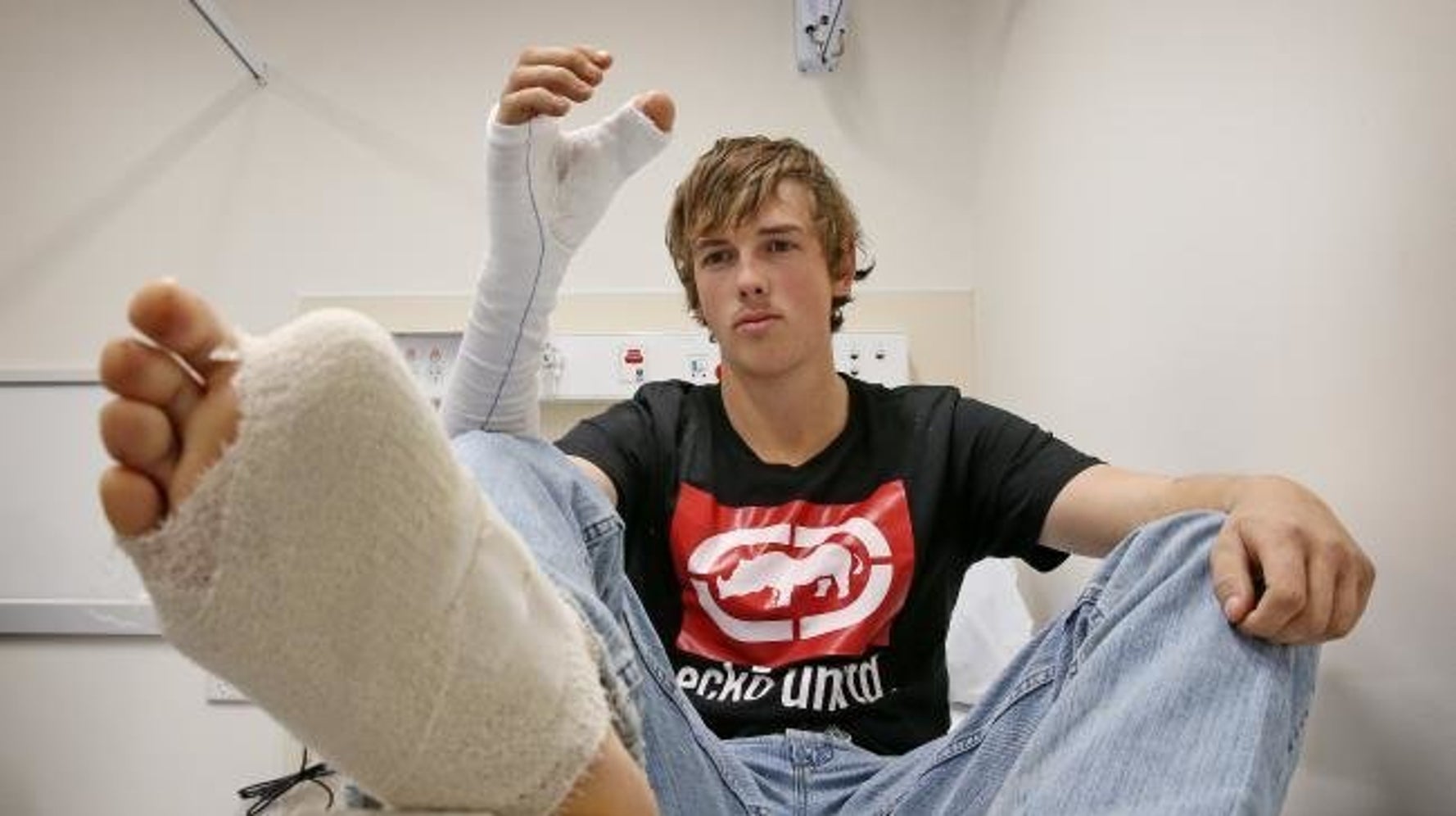 Man Has Big Toe Removed To Replace Thumb Ripped Off In Accident ...