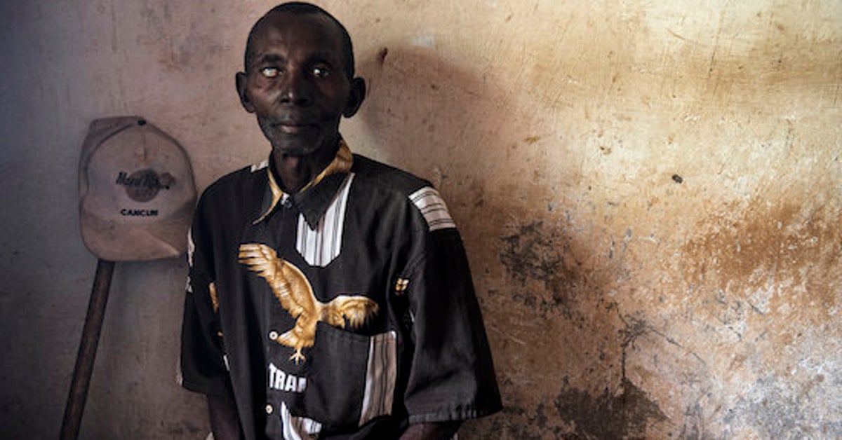 A Devastating Blinding Disease Is Crippling Communities In Africa, But ...