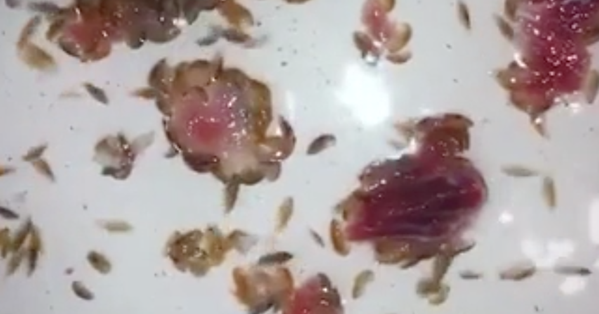 Melbourne Teenager Bloodied By Swarm Of Meat-Eating Sea Lice | HuffPost ...