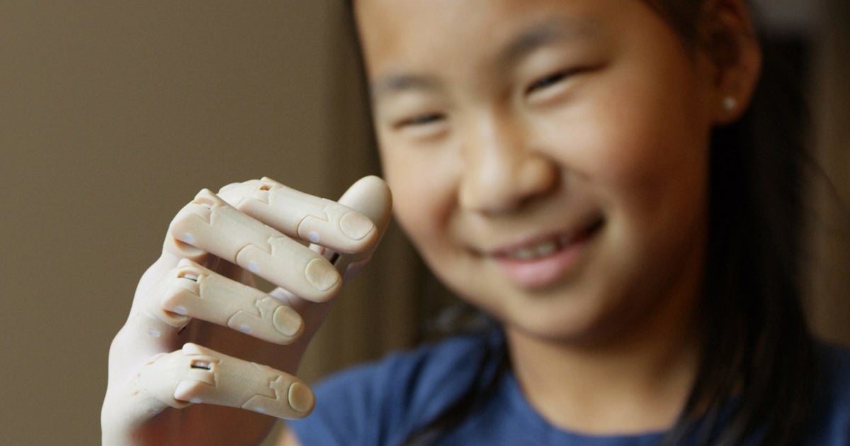 This Could Be The Most Advanced Robotic Prosthetic Arm We've Ever Seen ...