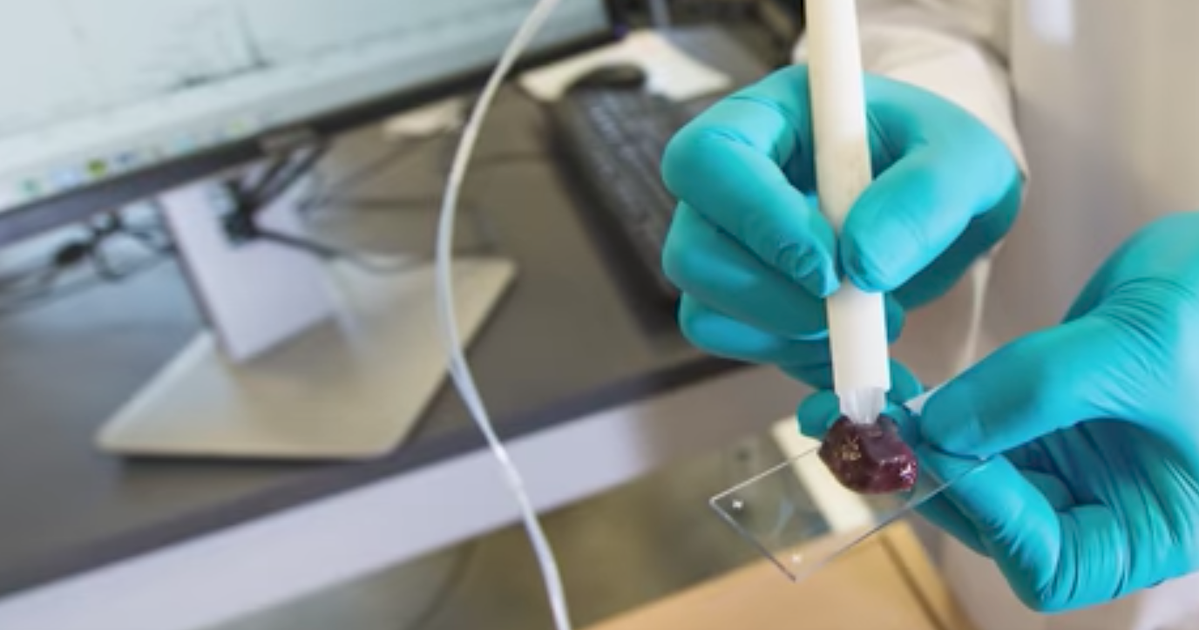 This Handheld 'Pen' Can Identify Cancerous Tissue In Just 10 Seconds ...