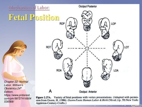 Fetal Position Transverse Baby Position: Causes And Safe Delivery