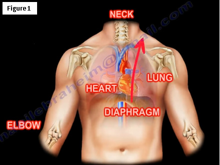 Referred Pain around the Shoulder | HuffPost
