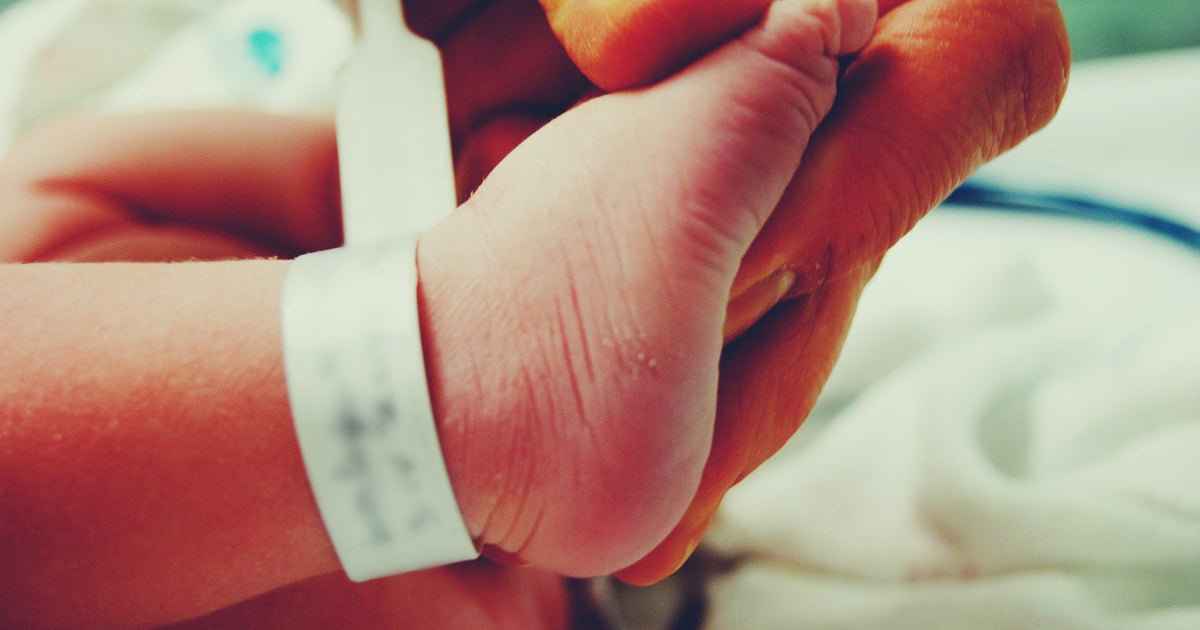 Doctors See A Surge In Babies With Syphilis-Associated Birth Defects ...