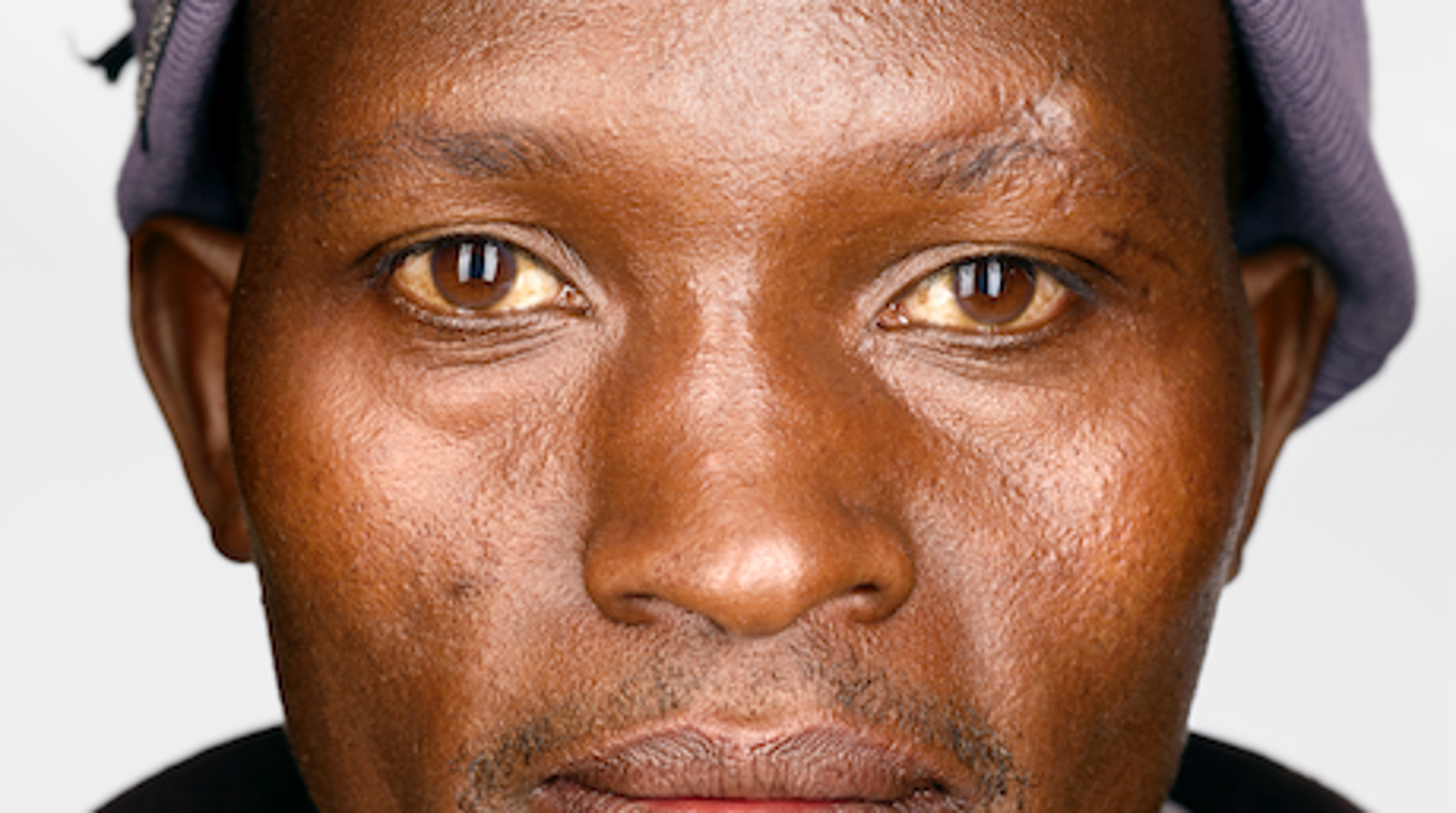 Stunning Photos Show Faces Of Poverty That Are Rarely Seen | HuffPost ...