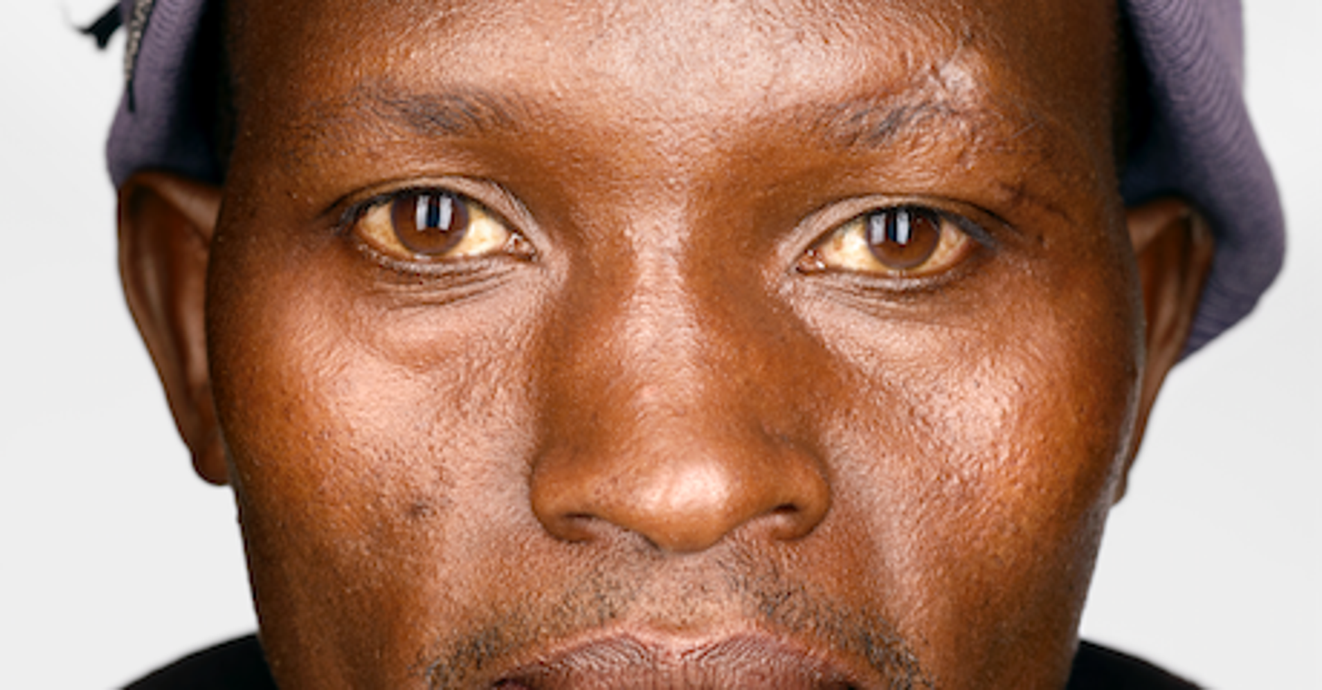 Stunning Photos Show Faces Of Poverty That Are Rarely Seen | HuffPost