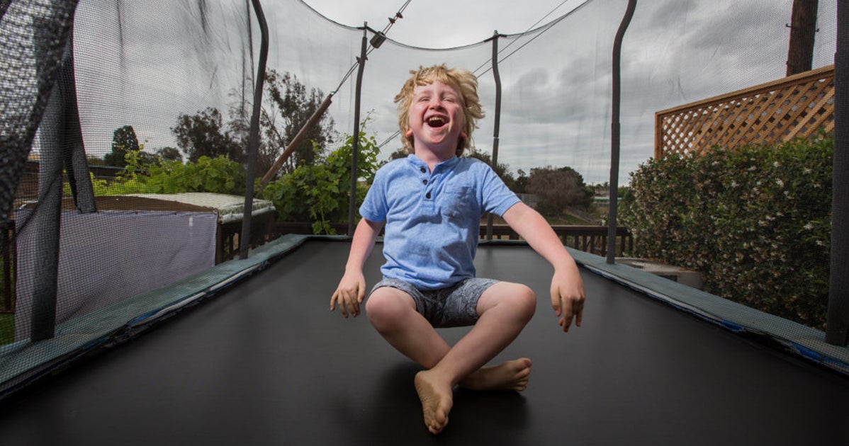 Photographer Highlights Kids With Rare Genetic Conditions In Stunning ...