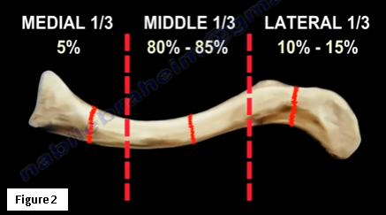 Clavicle Fractures | HuffPost