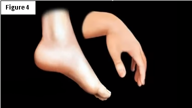 Lead Poisoning | HuffPost