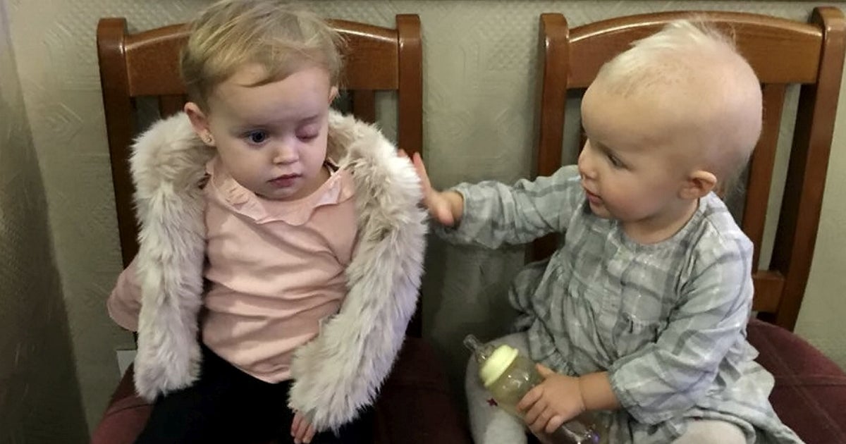 Toddler's Life Was Saved Because A Mum Shared This Photo Of Her ...