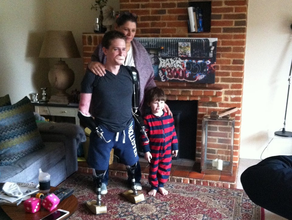Losing Four Limbs Made Me Literally Half The Man I Used To Be - But ...