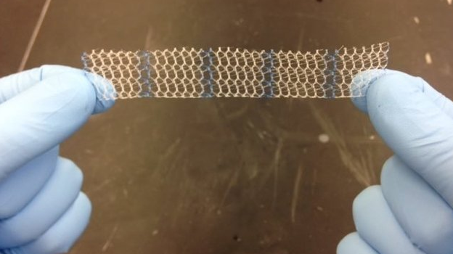 Government Suspends Use of Vaginal Mesh To Treat Stress Incontinence ...