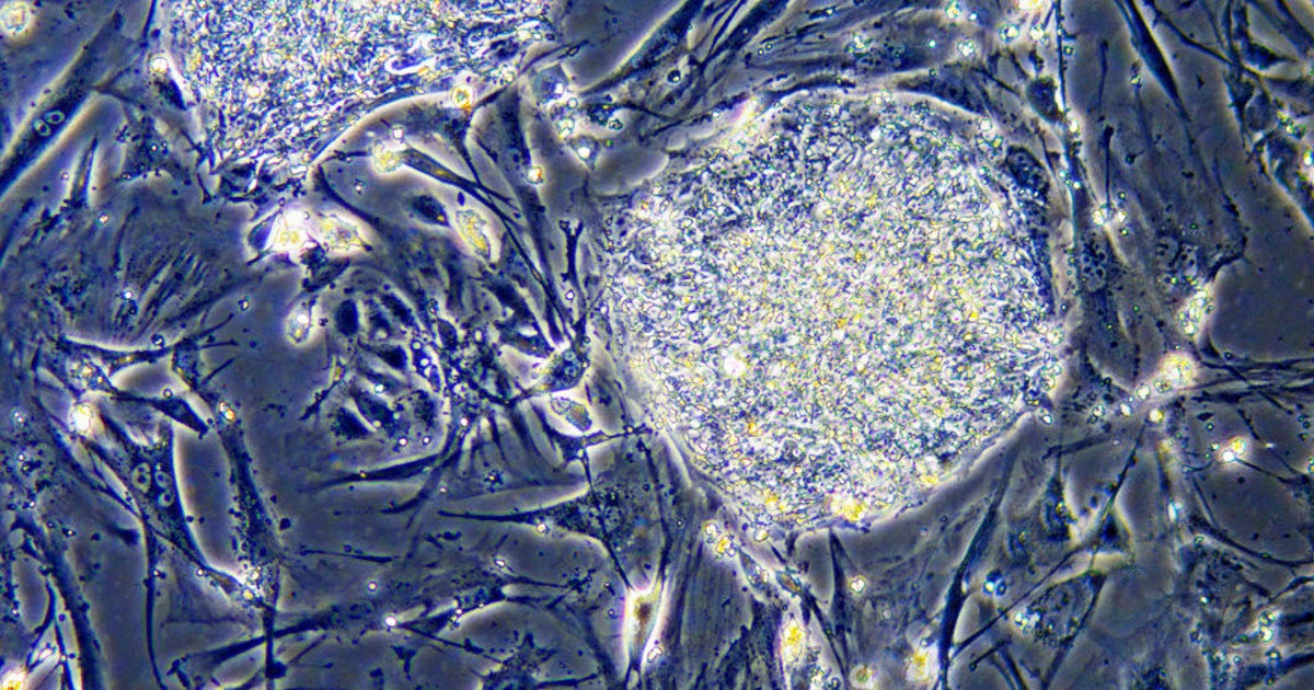 'Zombie Cells' Stronger Than Living Counterparts | HuffPost Videos