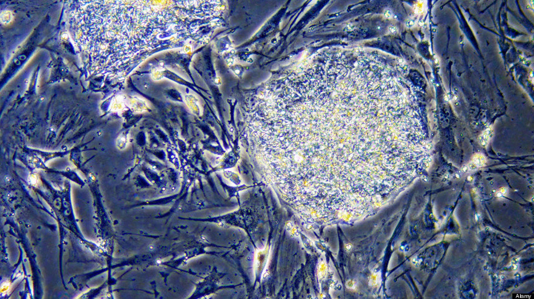 'Zombie Cells' Stronger Than Living Counterparts | HuffPost Videos