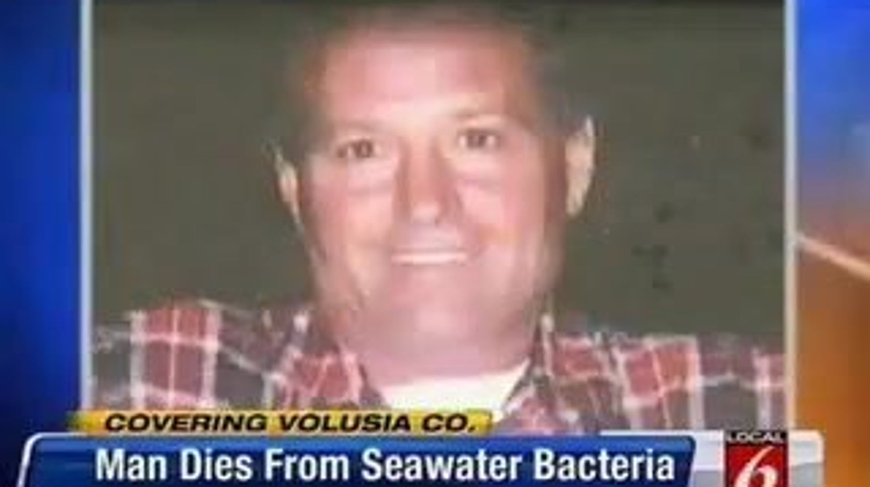 Florida Man Dies From Flesh Eating Bacteria Infection Huffpost
