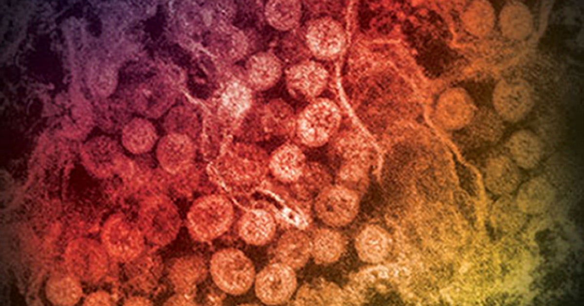 First Case Of Deadly Mers Virus Confirmed In England Since 2013 ...