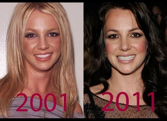 Aging Celebrities Before And After