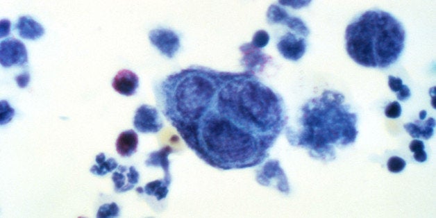 Pritelivir, Genital Herpes Treatment, Shows Promise | HuffPost UK Wellness