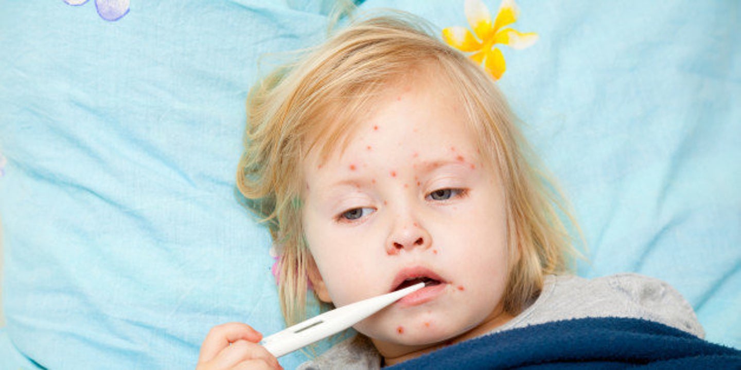 Do Not Bring Your Kids To 'Measles Parties,' Doctors Warn | HuffPost Life