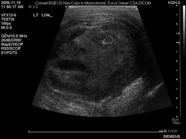 Amazing X-Rays (PHOTOS) | HuffPost Weird News