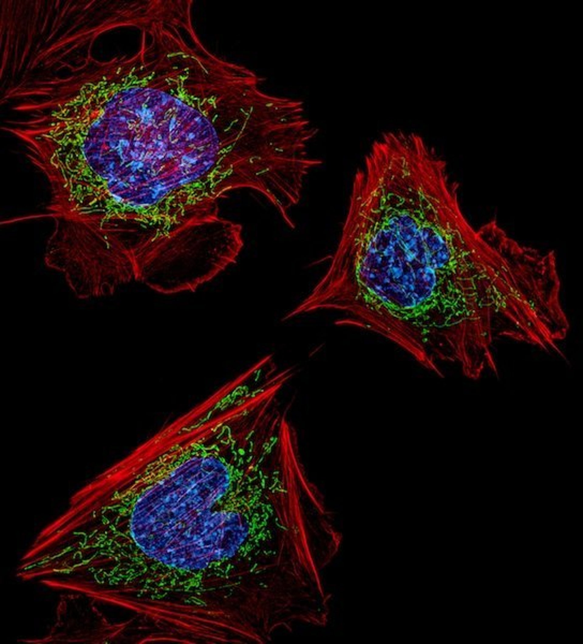 11 Spectacular Photos That Make Microscopic Realm Look Enormous ...