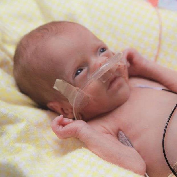Ruby Love Lambright, Premature Baby Born At 1.6 Pounds, Inspires ...