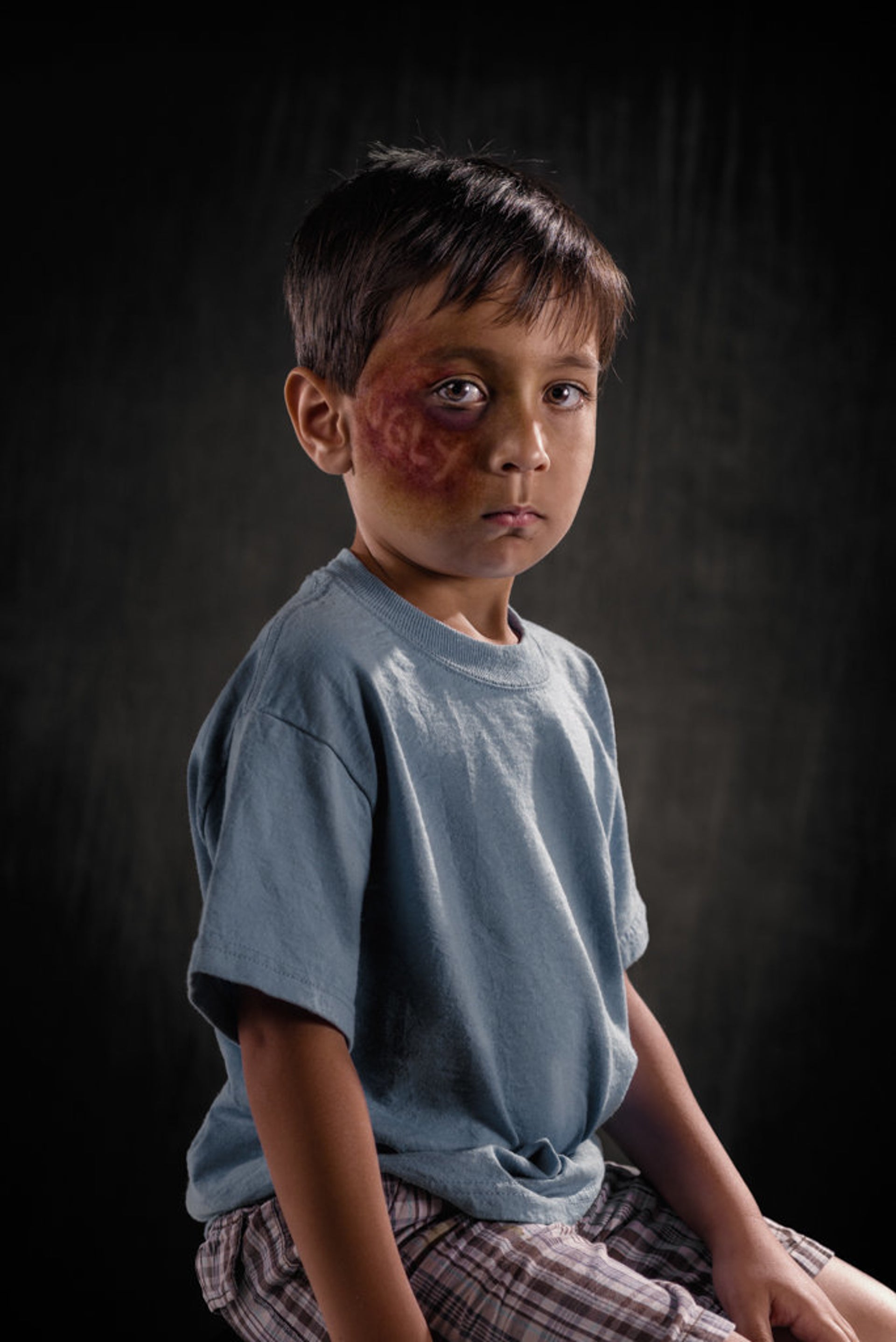 Powerful Images Show A World Where Verbal Abuse Leaves Physical Scars ...
