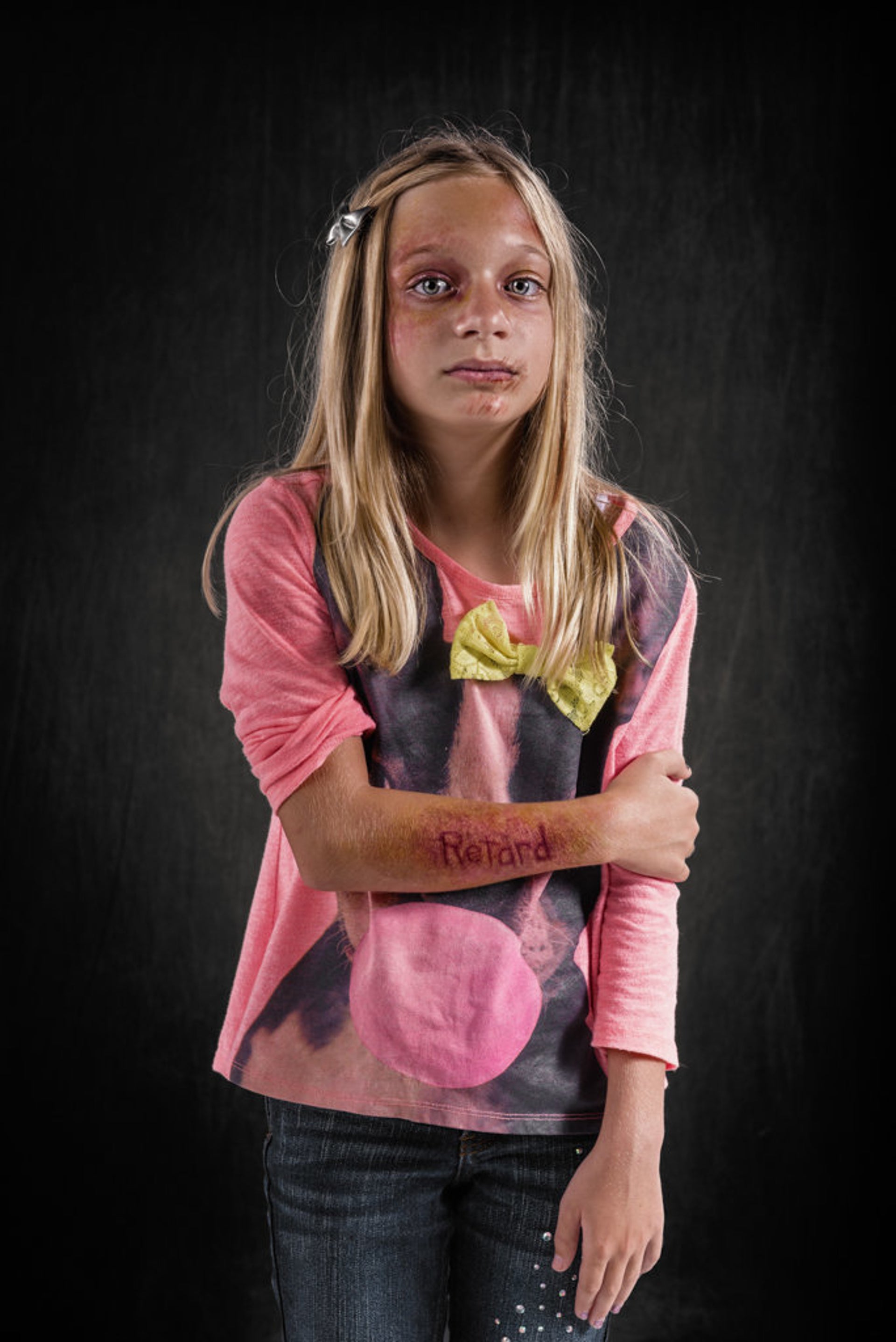 Powerful Images Show A World Where Verbal Abuse Leaves Physical Scars ...