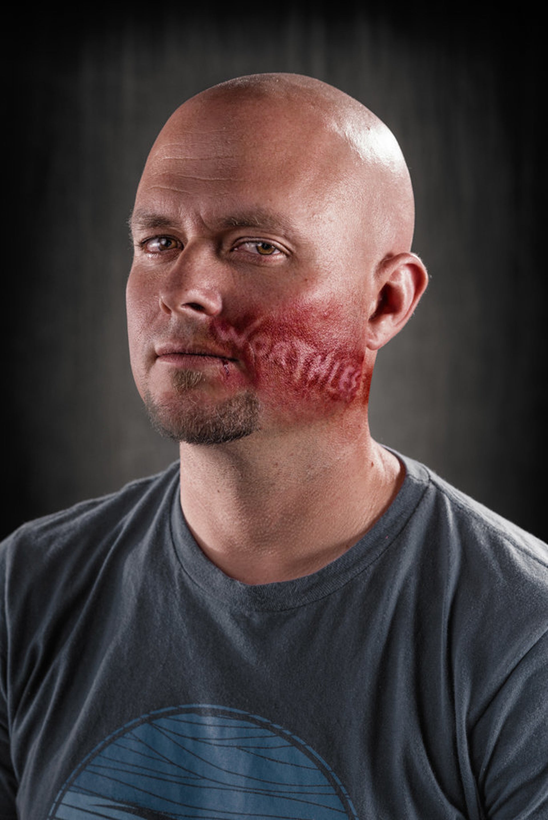 Powerful Images Show A World Where Verbal Abuse Leaves Physical Scars ...