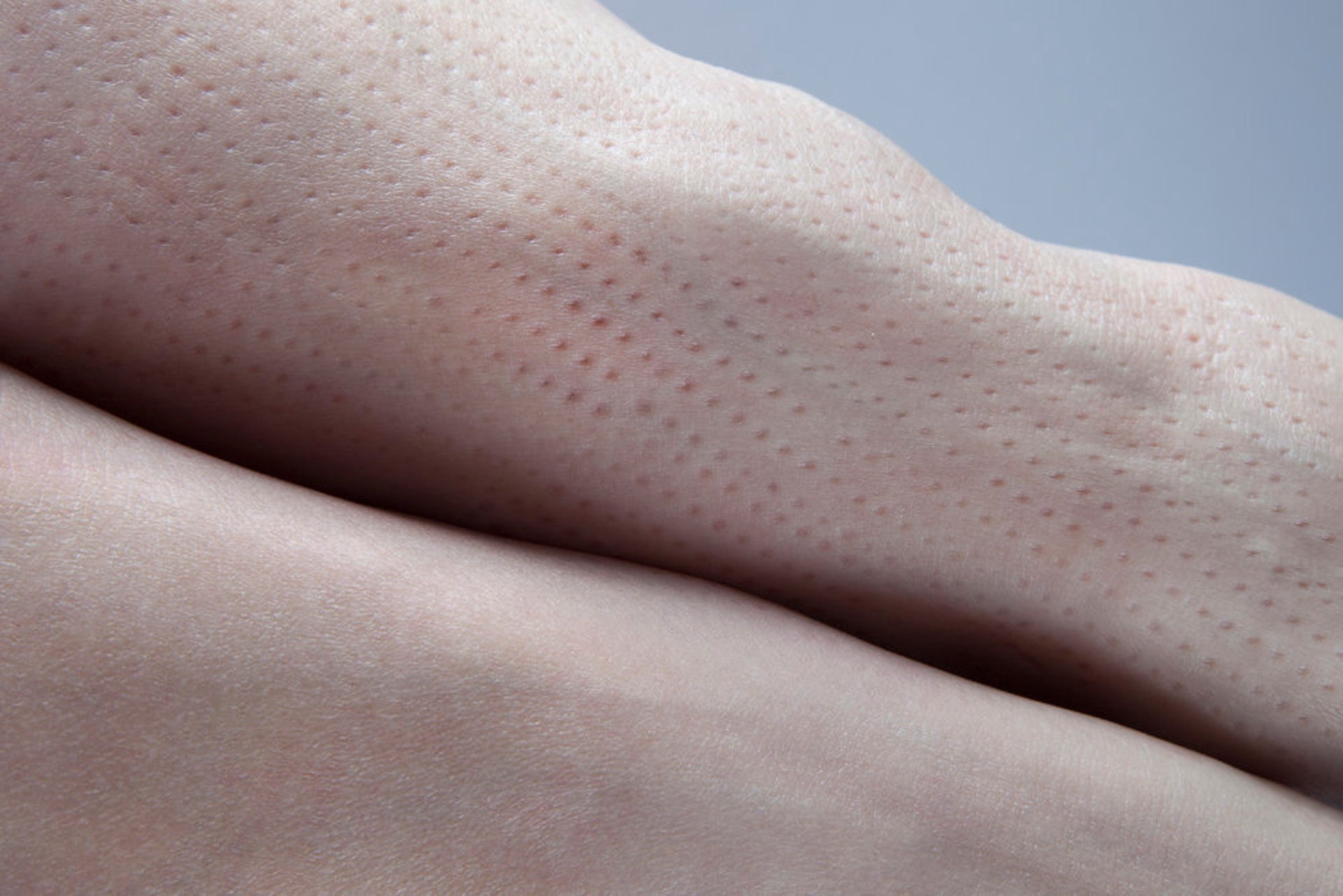 Dutch Artist Tests The Limits Of Human Skin In The Perfect Anti ...