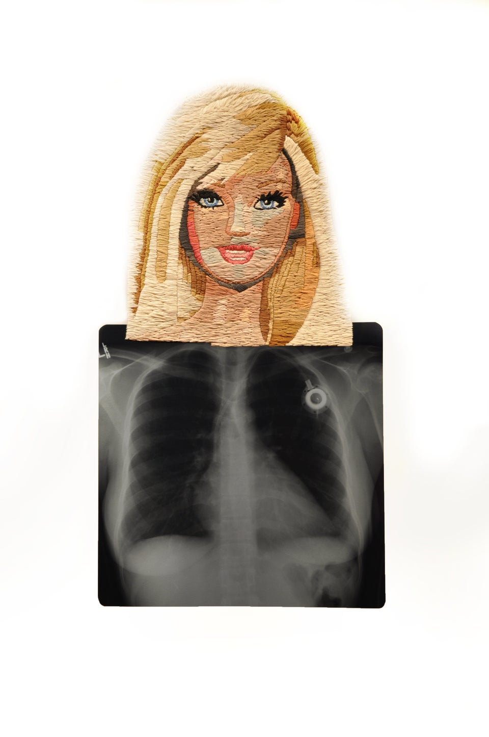 Artist Turns Found X-Rays Into Ghostly, Embroidered Works Of Art ...