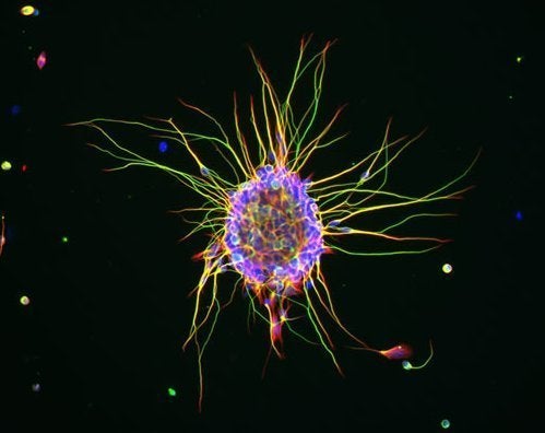 Uracil: NASA Reproduces A Building Block Of Life In Laboratory ...