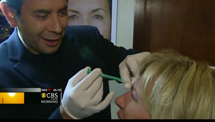 Botox Is Ten Years Old This Month (VIDEO) | HuffPost Post 50