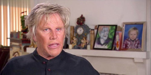 Gary Busey Motorcycle Accident Before And After Gary Busey Actor,
