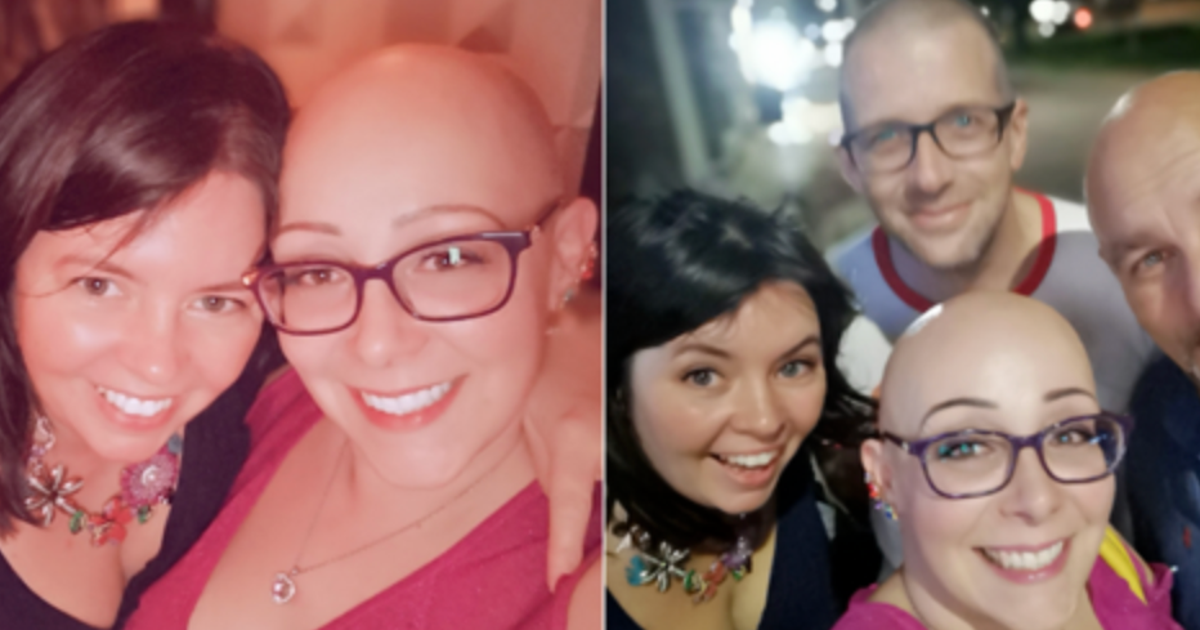 Life As A Bald Woman Isn't As Bad As I Feared | HuffPost UK Life