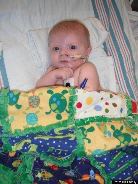 Seth Petreikis, Baby With Complete DiGeorge Syndrome, Dies Awaiting ...